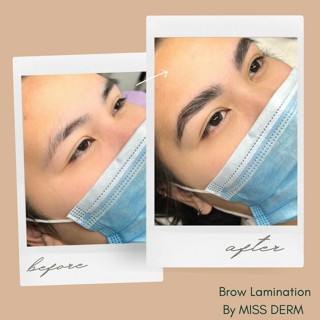 Brow Lamination