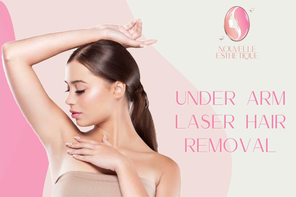 Diode Hair Removal: Underarm (5 sessions)