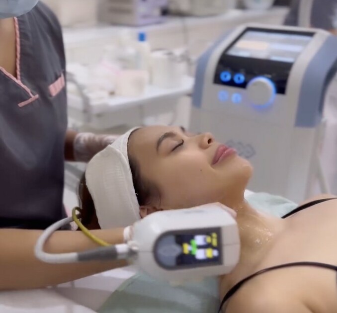 5 Sessions- Exilis Ultra for Face and Neck
