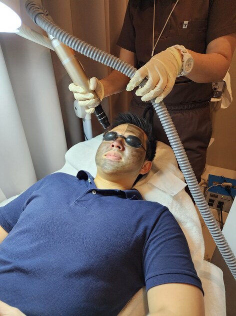 Picosecond Carbon Laser Treatment for Face